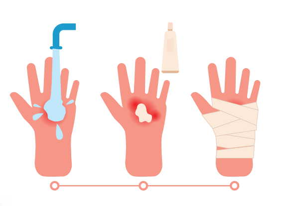 Pulmonary Embolism - Health City Cayman Islands